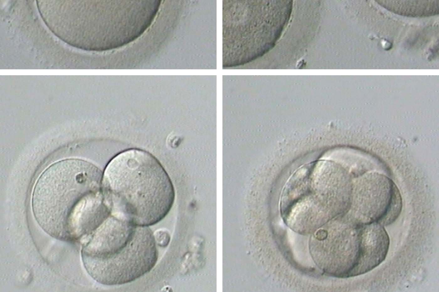 ¿Qué es un blastocisto?